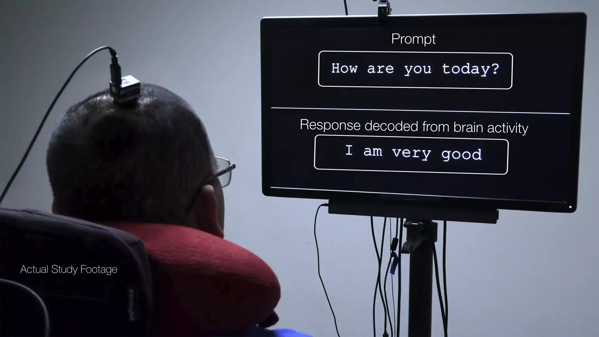 Implantul cerebral îi permite omului paralizat să „vorbească” propoziții complete