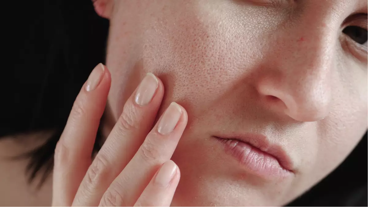Uma mulher esfregando o rosto. Poros grandes e expostos são mostrados.